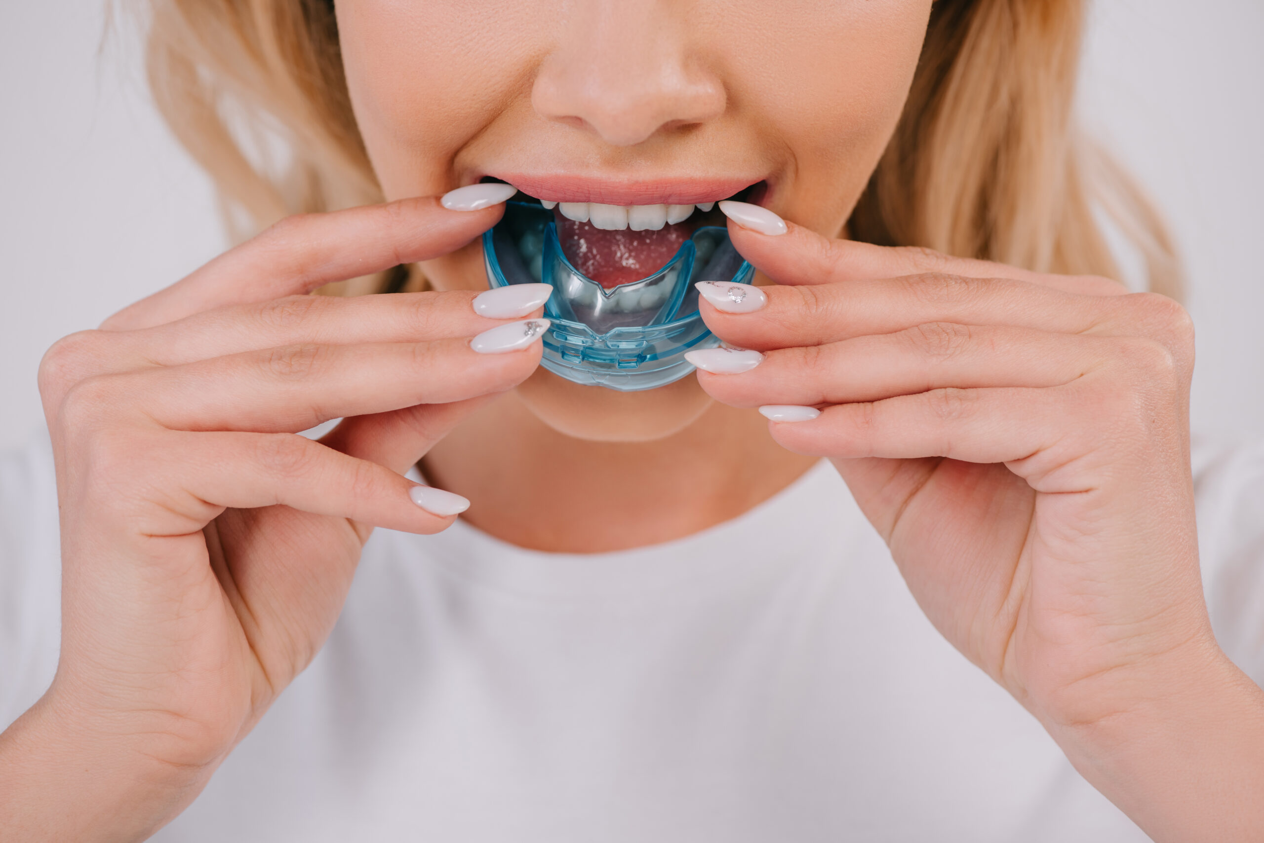 Denti perfetti a Milano | Trattamenti odontoiatrici per il tuo sorriso ...